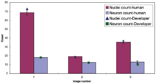 IN Cell Analyzer 1000を用いた神経幹細胞分化の定量