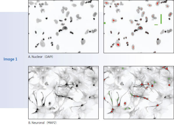 IN Cell Analyzer 1000を用いた神経幹細胞分化の定量