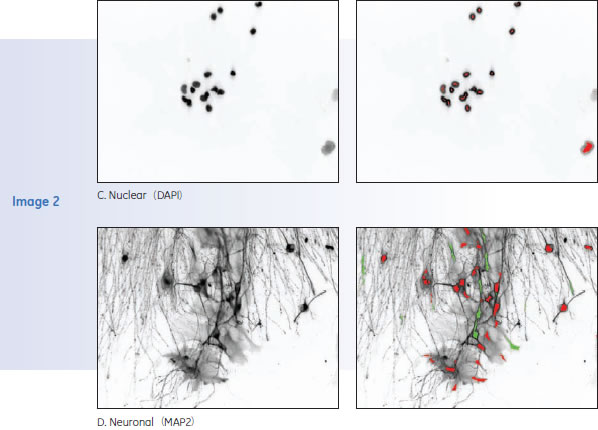 IN Cell Analyzer 1000を用いた神経幹細胞分化の定量