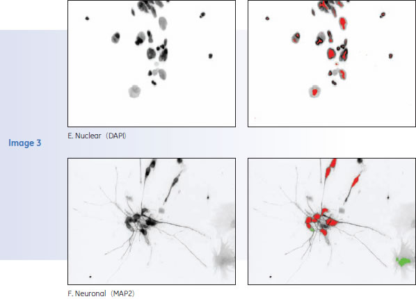 IN Cell Analyzer 1000を用いた神経幹細胞分化の定量