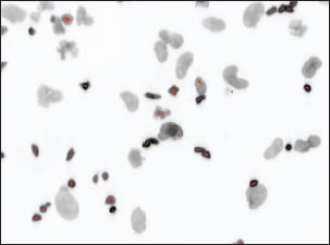 IN Cell Analyzer 1000を用いた神経幹細胞分化の定量