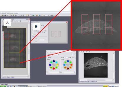 IN Cell Analyzer 2000を用いた肝臓切片ポピュレーション解析